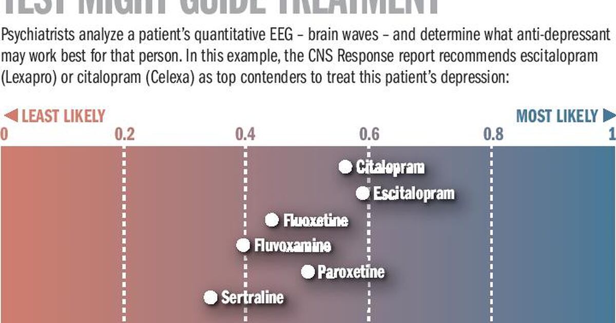 Study uses EEGs to guide treatment for depression