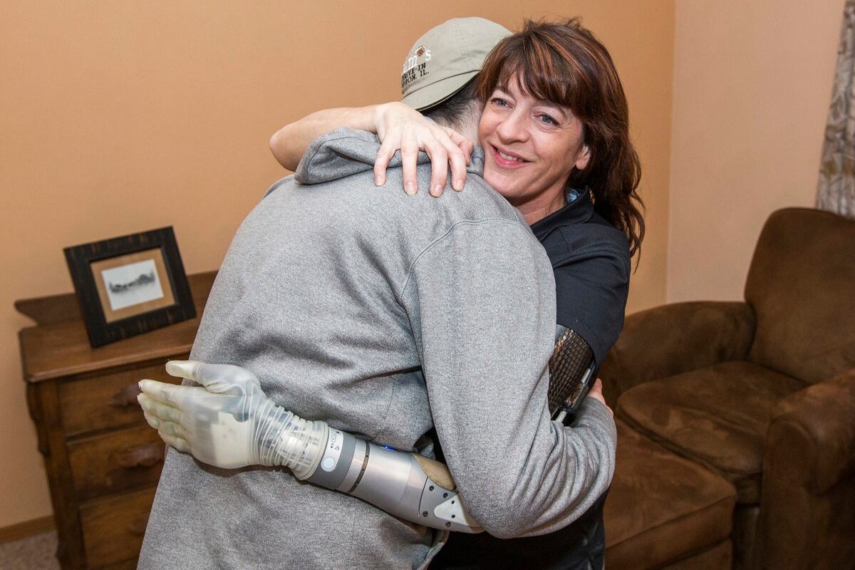 Army veteran grateful for donated bionic arm