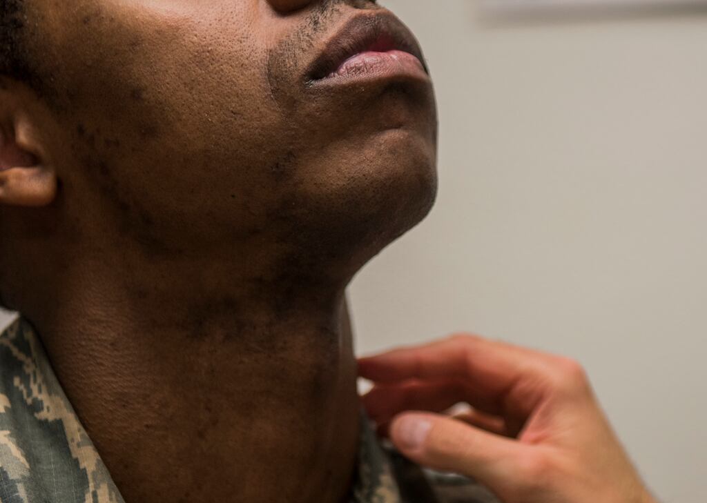 Marine Corps tightens rules on shaving waivers for medical conditions