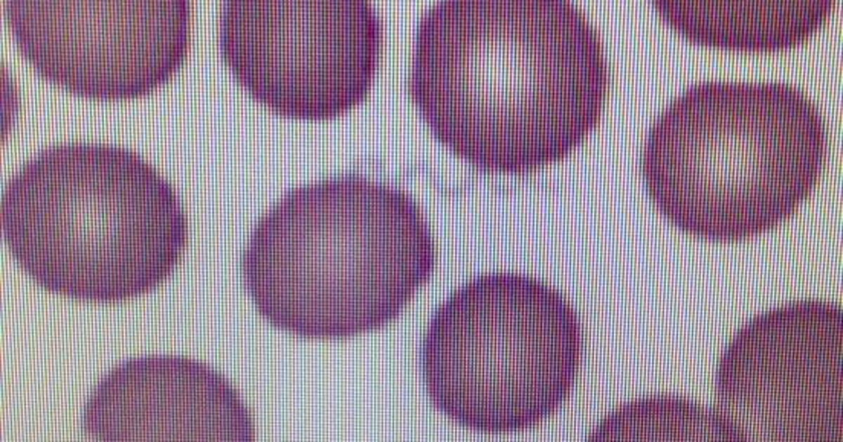 Air Force med group finds rare animal bacteria in soldier